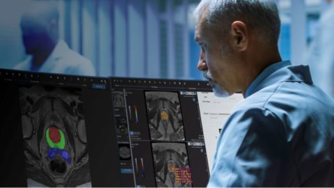 ProCAncer-I | An AI Platform integrating imaging data and models ...