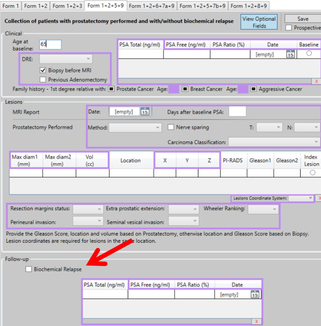 Clinical Challenge: Can artificial intelligence based mpMRI with ...